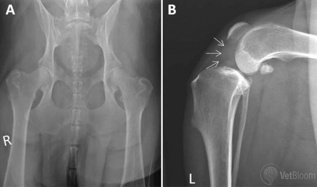 Indications and candidate screening for total hip replacement in the ...