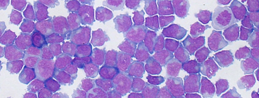 Lymphoma In A Dog Eclinpath