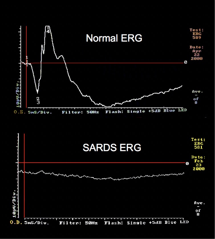 Sudden Acquired Retinal Degeneration Syndrome (SARDS) - VetBloom